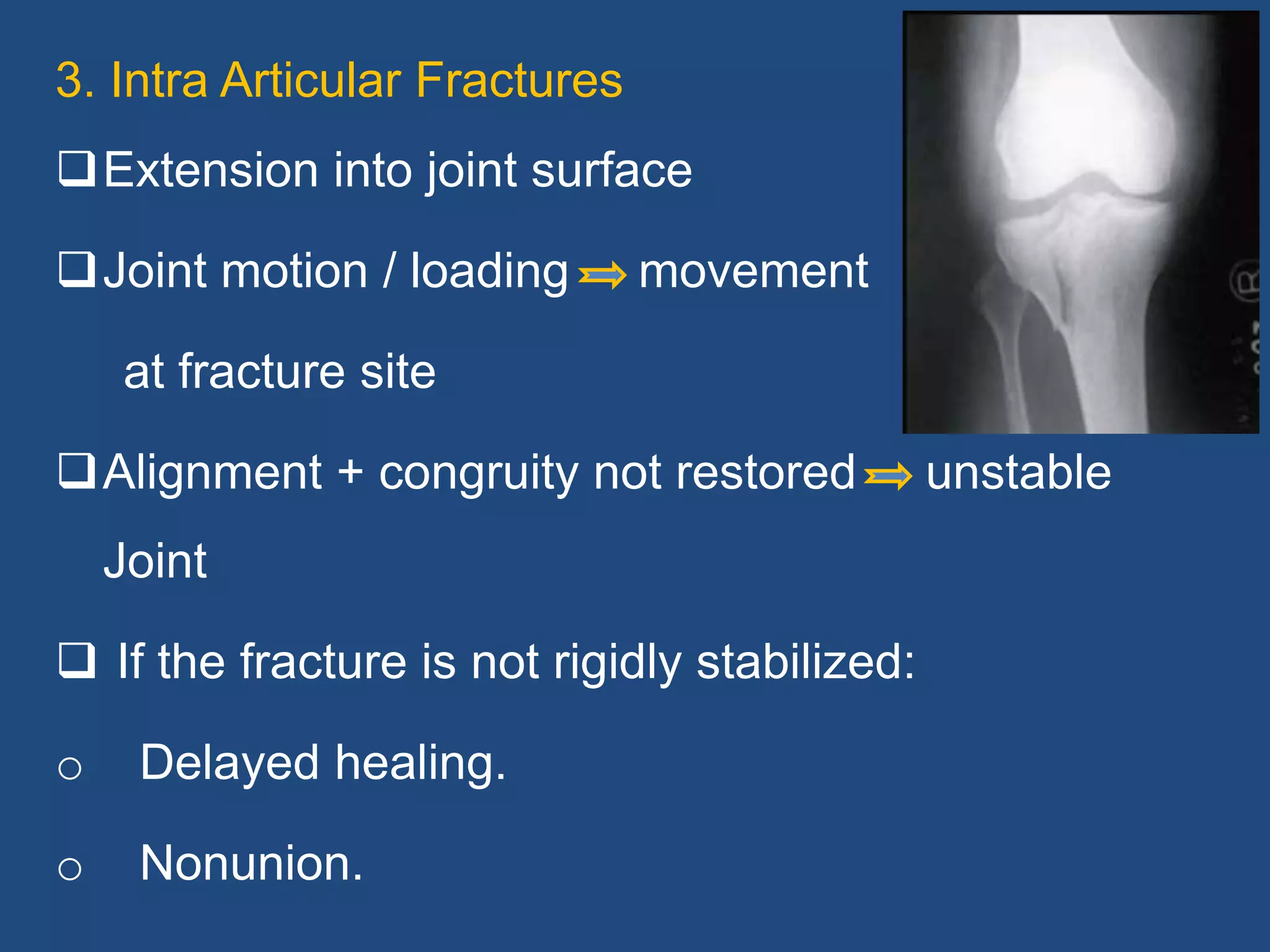 Fracture healing latest | PPTX