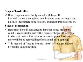 Fracture Healing Methods.pptx