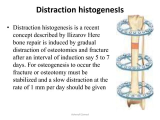 Fracture Healing Methods.pptx