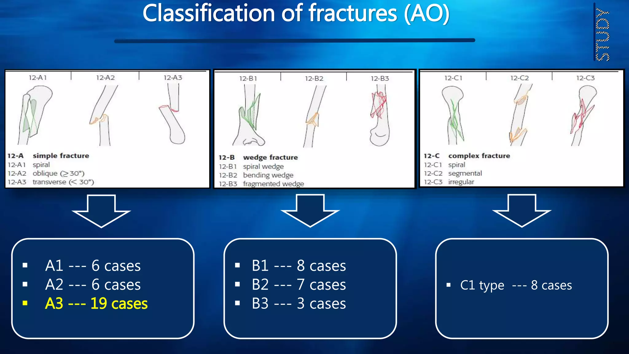 Fracture humerus shaft in adults | PPTX