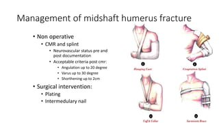 Fracture humerus with radial nerve injury | PPTX