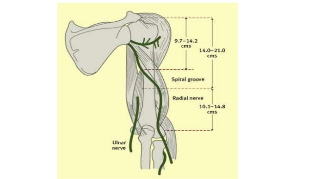 Radial Nerve Humerus Brachial Plexus At University Of Toledo College