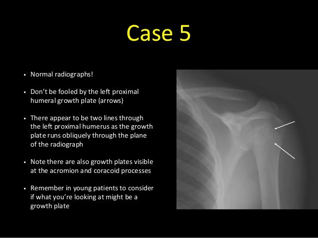 Fracture interpretation for medical students