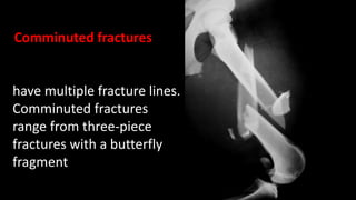 Fracture its types classification and manangment | PPTX