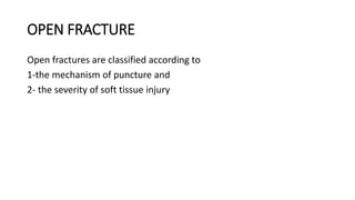 Fracture its types classification and manangment | PPT