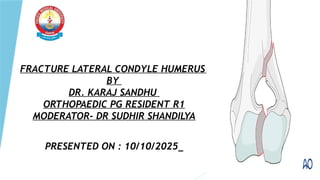 FRACTURE LATERAL CONDYLE HUMERUS BY DR KARAJ SANDHU.pptx