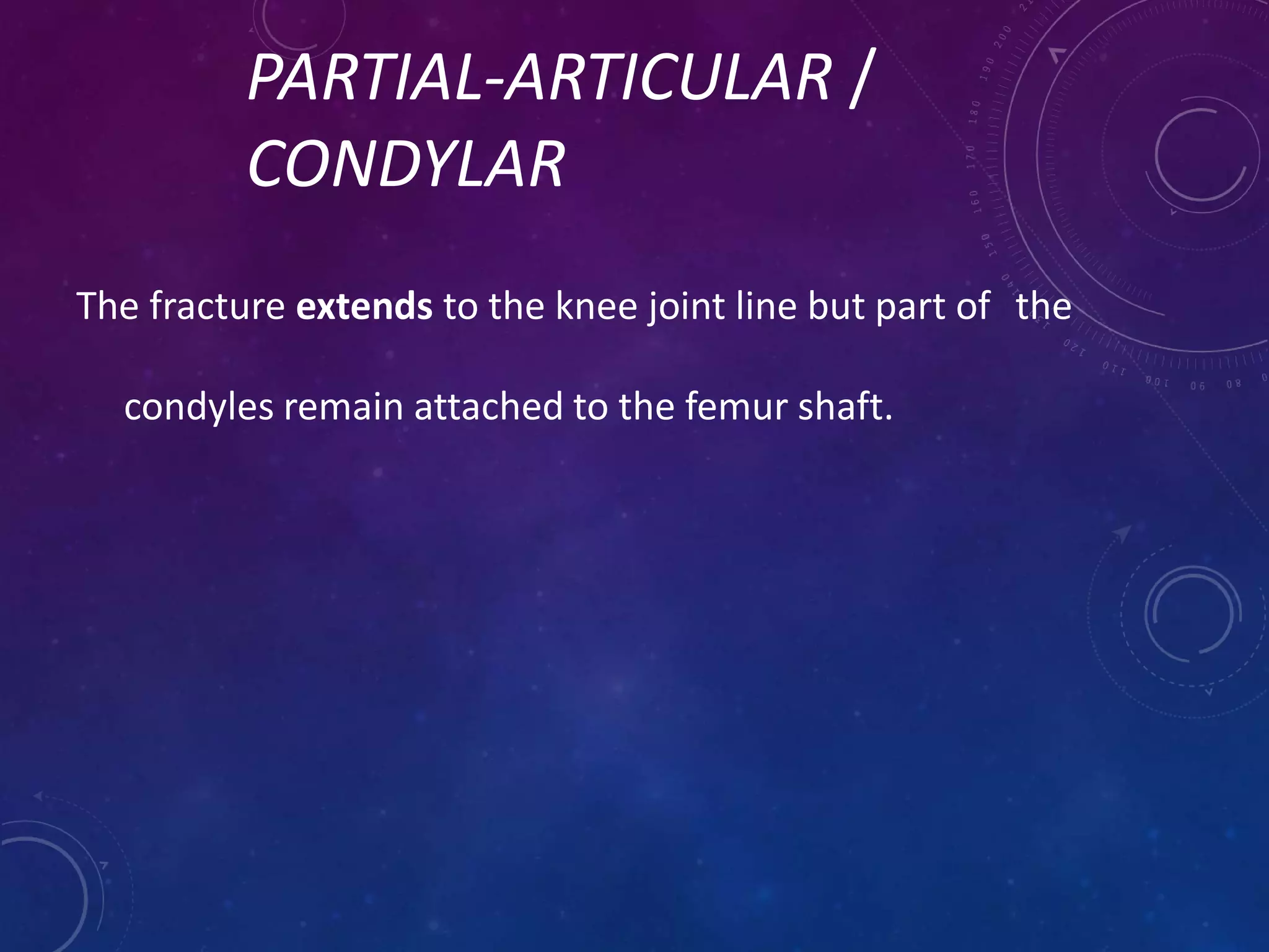 fracture lower limb.pptx