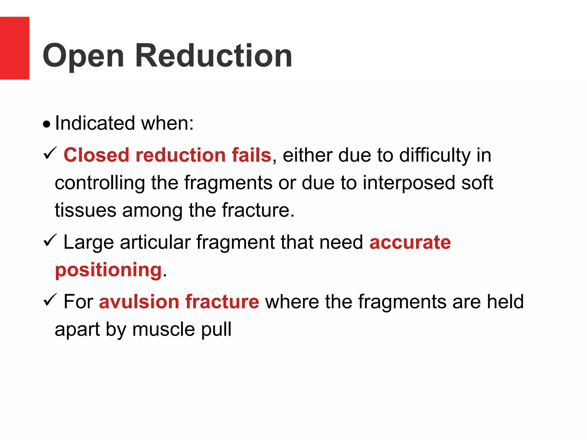 Principle of Fracture Management | PPTX