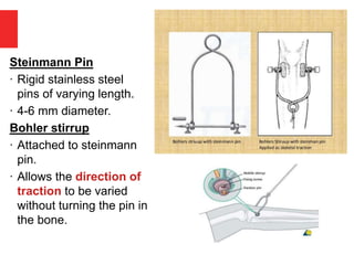 Principle of Fracture Management | PPTX