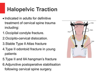 Principle of Fracture Management | PPTX