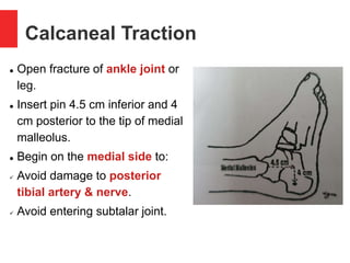 Principle of Fracture Management | PPT