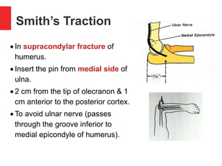 Principle of Fracture Management | PPT