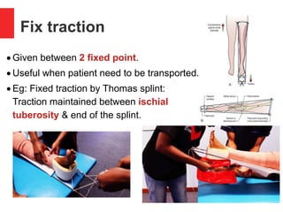 Principle of Fracture Management | PPT