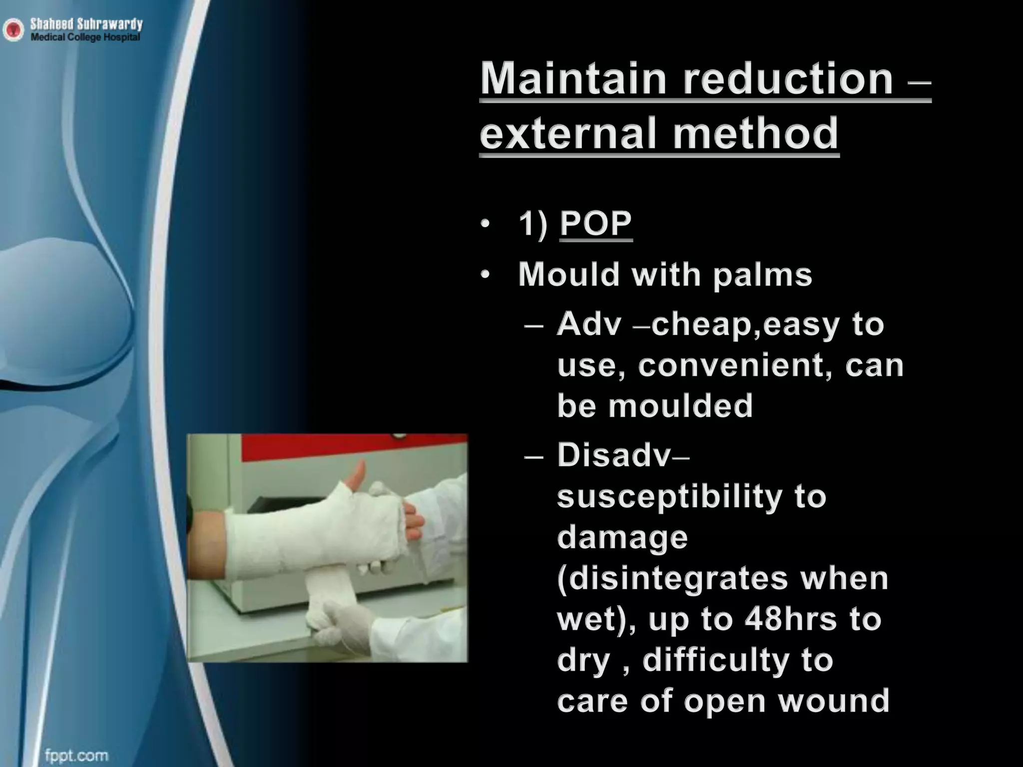 Fracture management -Basic | PPTX