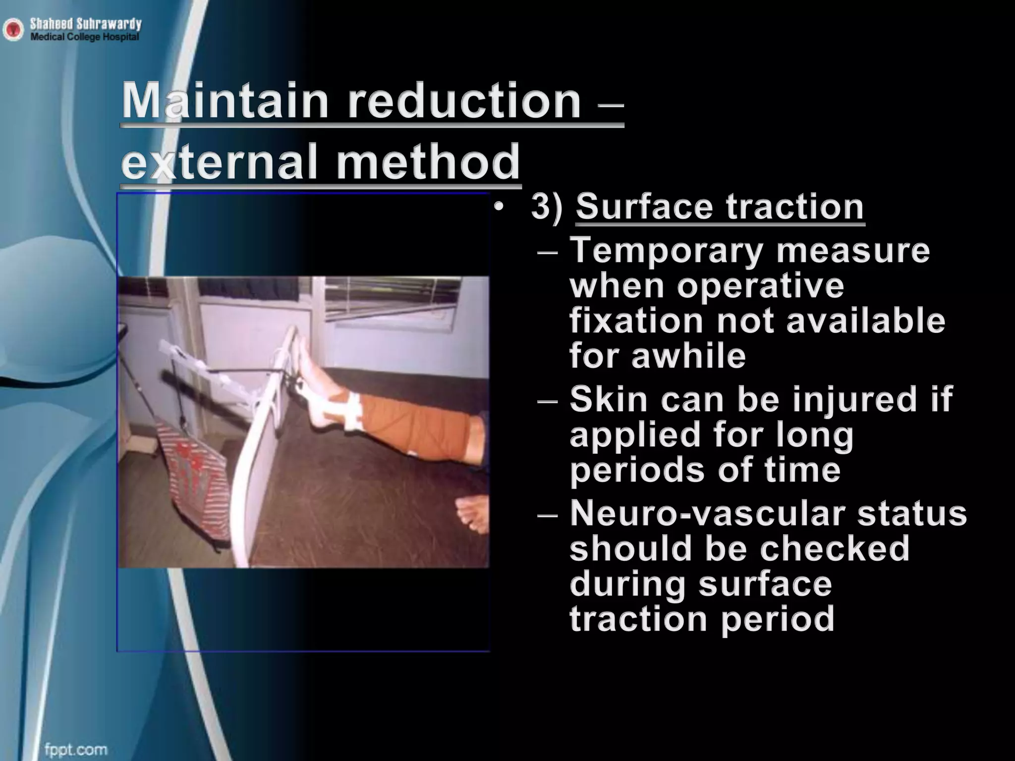 Fracture management -Basic | PPTX