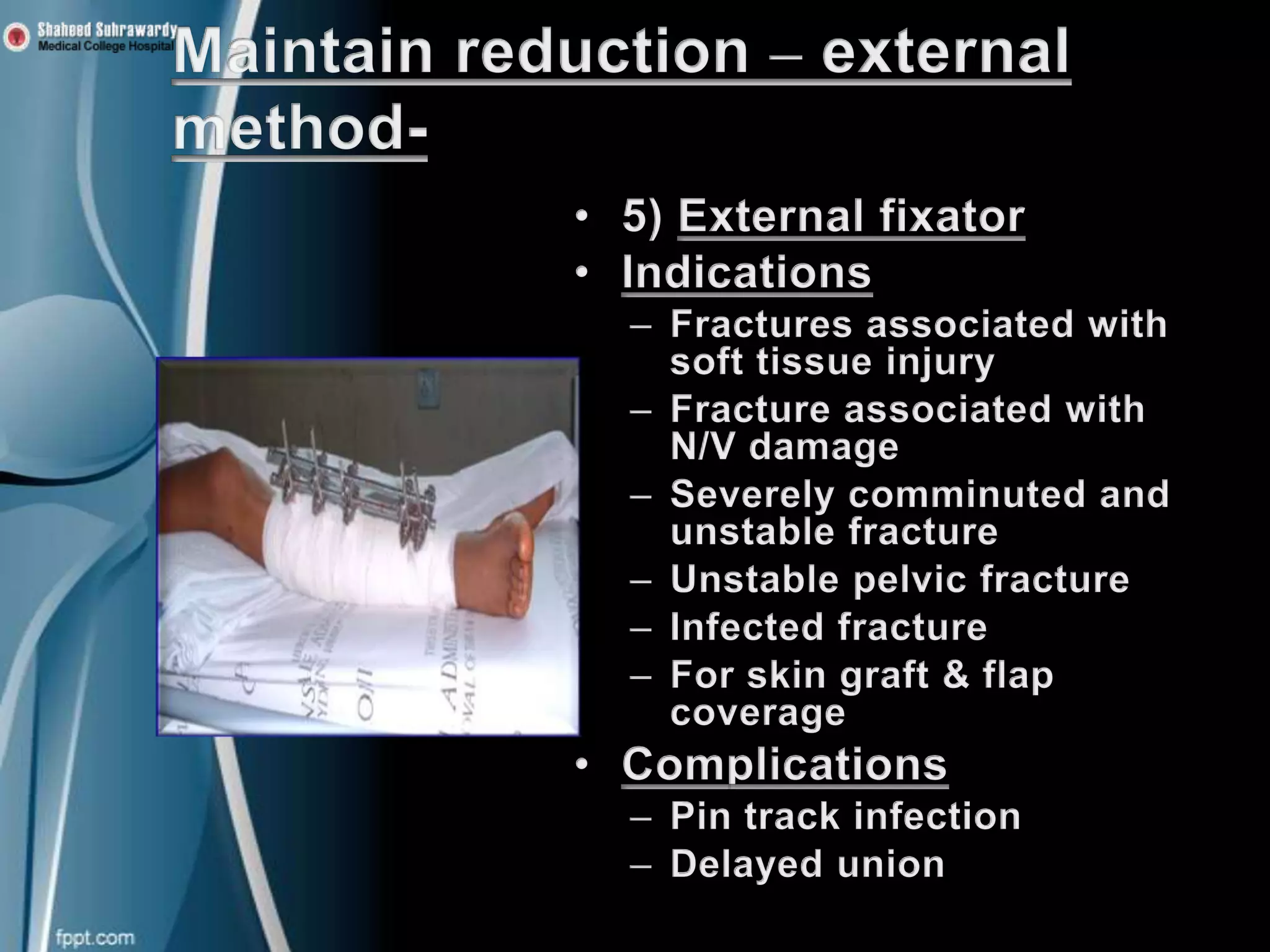 Fracture management -Basic | PPTX