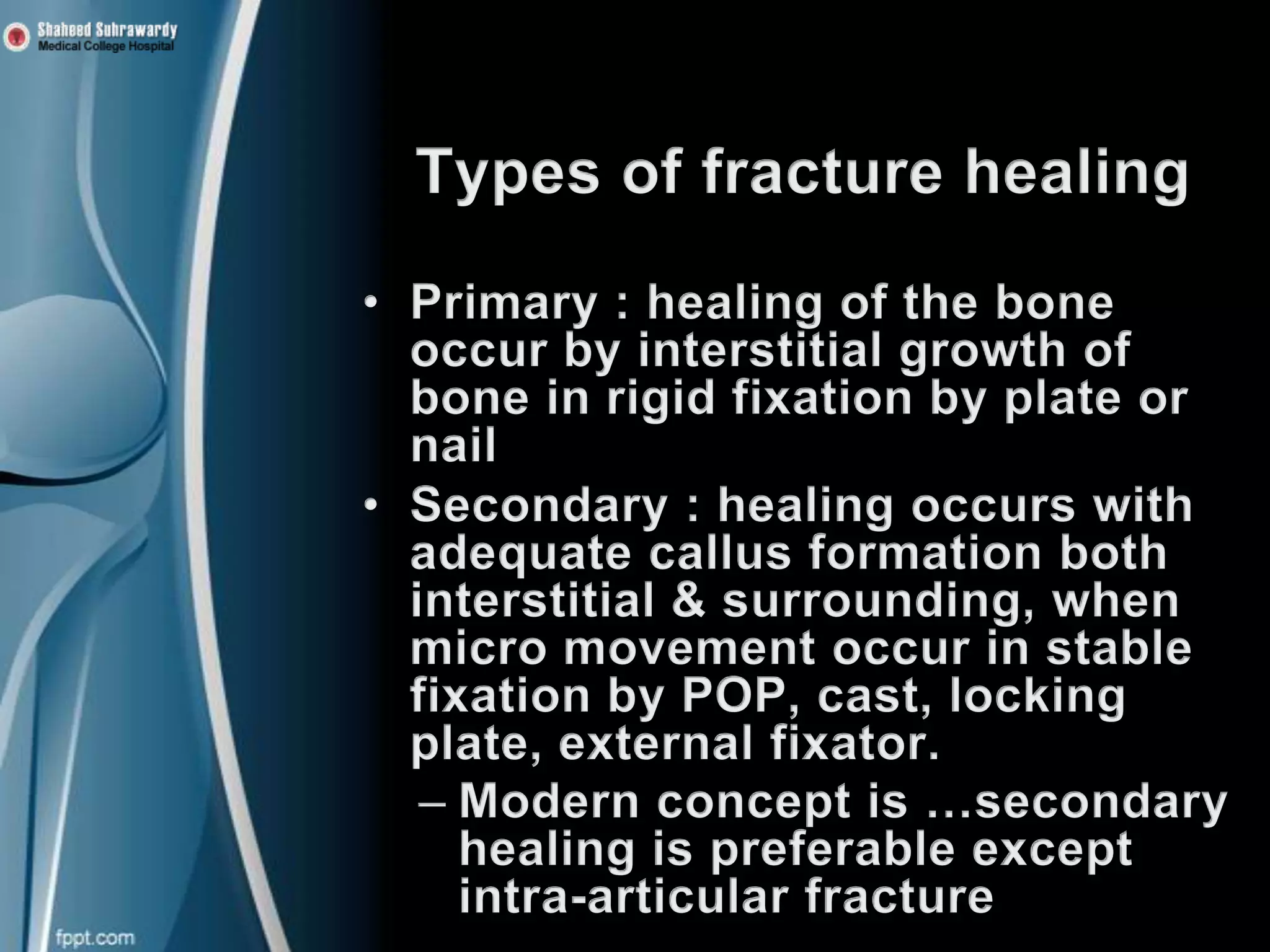 Fracture management -Basic | PPTX