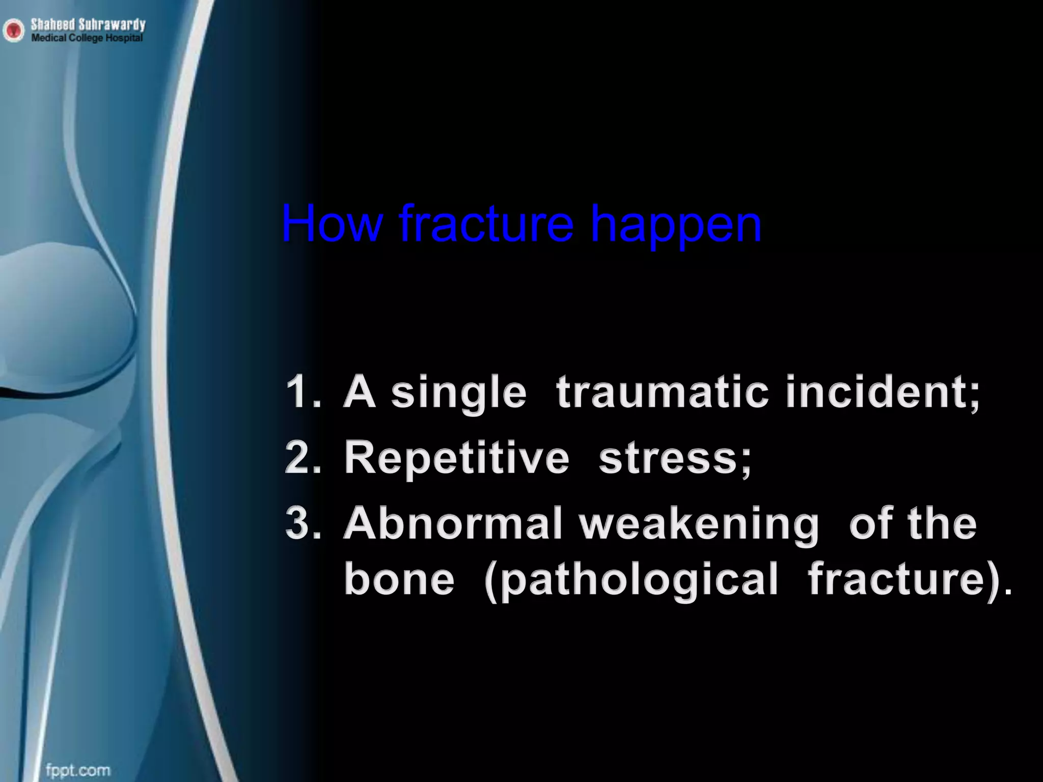 Fracture management -Basic | PPTX
