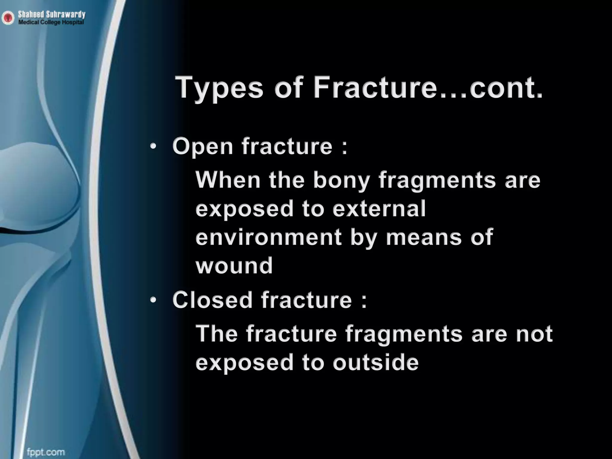 Fracture management -Basic | PPTX