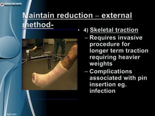 Fracture management -Basic | PPTX