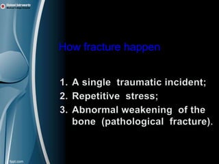 Fracture management -Basic | PPTX