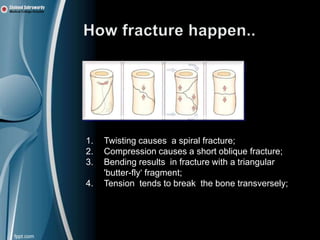 Fracture management -Basic | PPTX