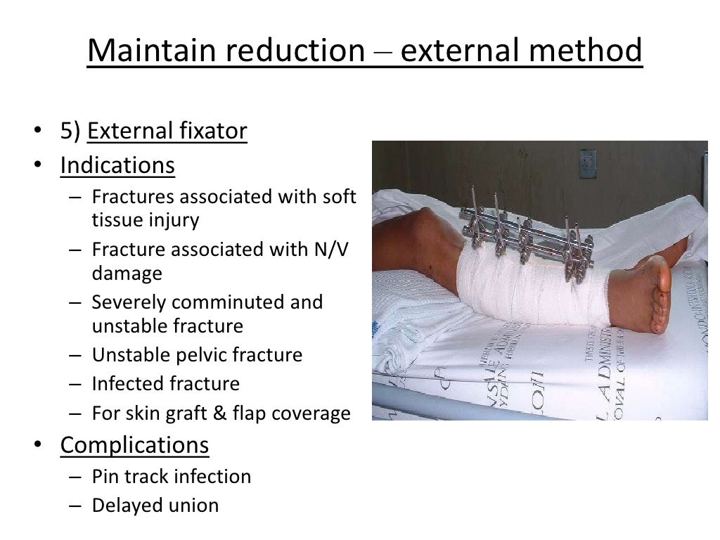 Fracture management -Basic