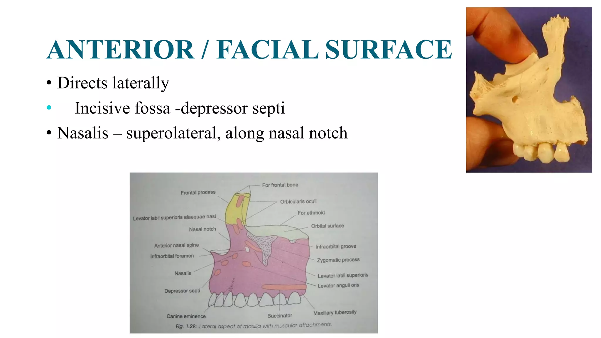 Fracture maxilla | PPTX