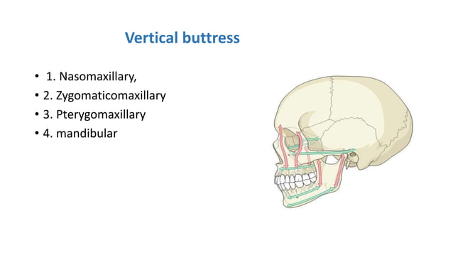 Fracture maxilla | PPTX | Death, Injury, or Military Conflict ...