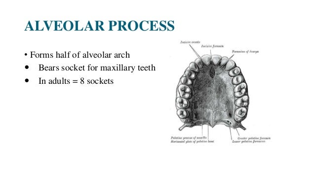 Fracture maxilla