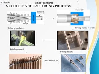 Fracture mechanics | PPT | First Aid | Injuries