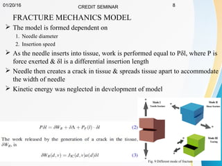 Fracture mechanics | PPT | First Aid | Injuries