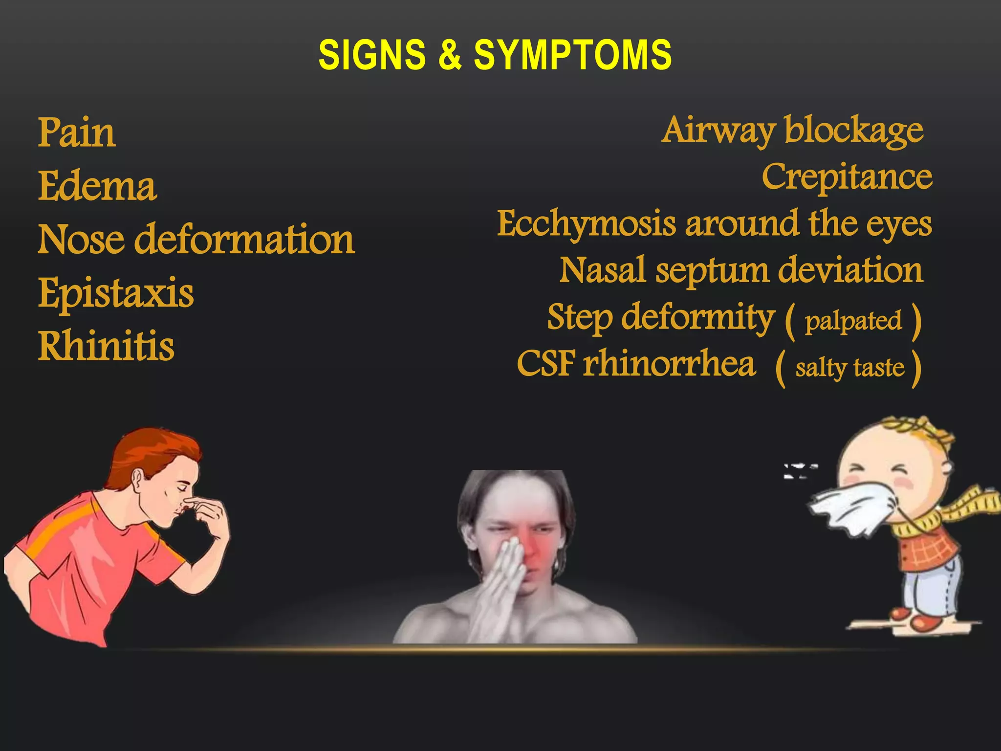 Mid facial fractures ( Mid facial trauma ) | PPTX