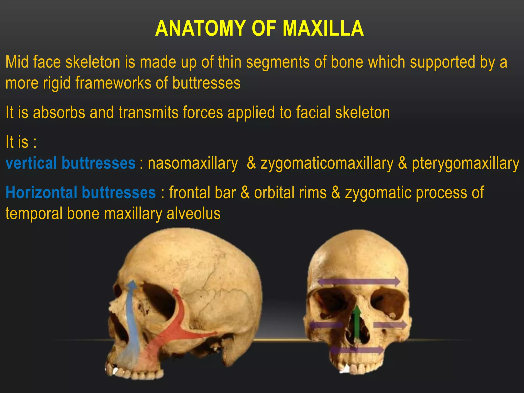 Mid facial fractures ( Mid facial trauma ) | PPTX