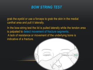 Mid facial fractures ( Mid facial trauma ) | PPT