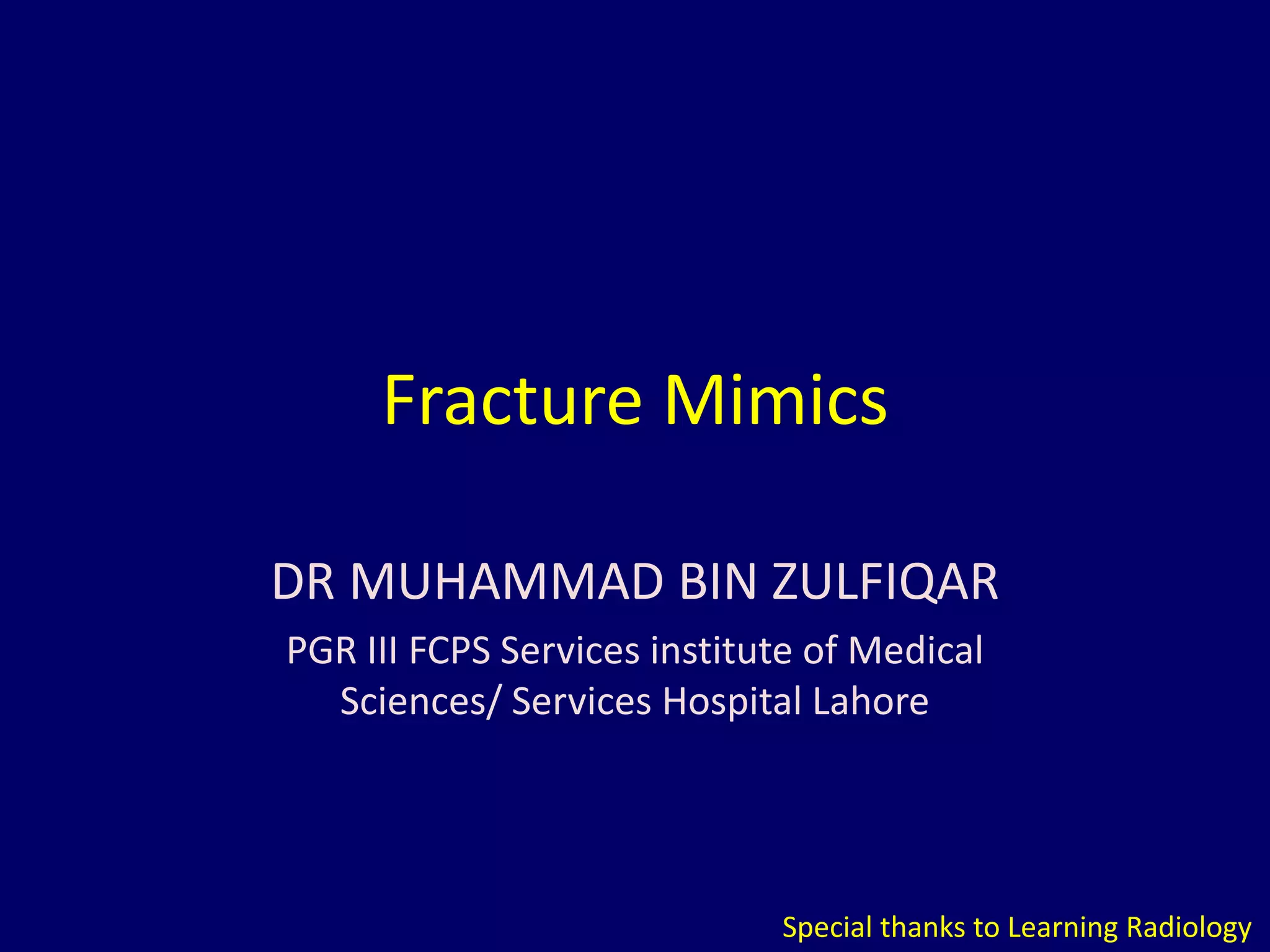 Fracture Mimics Dr. Muhammad Bin Zulfiqar | PPTX