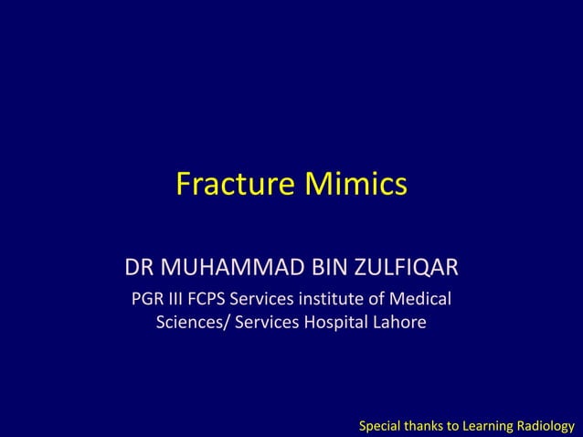Fracture Mimics Dr. Muhammad Bin Zulfiqar | PPT