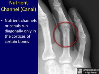 Fracture Mimics Dr. Muhammad Bin Zulfiqar | PPTX