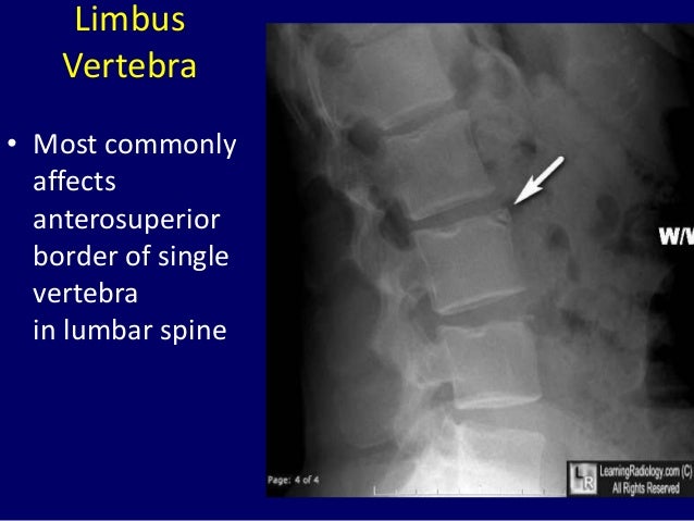 Fracture Mimics Dr. Muhammad Bin Zulfiqar