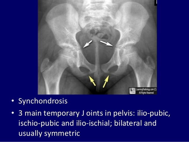 Fracture Mimics Dr. Muhammad Bin Zulfiqar