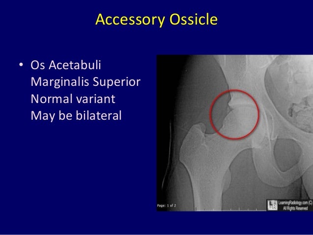 Fracture Mimics Dr. Muhammad Bin Zulfiqar