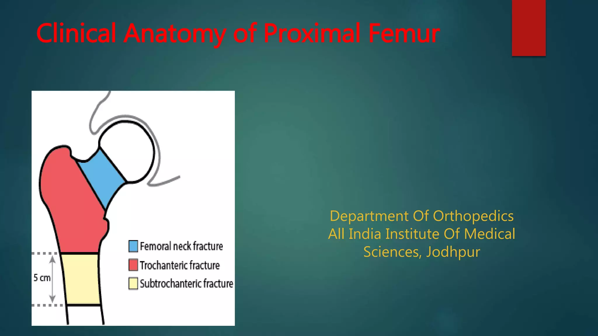 clinical anatomy of proximal femur | PPTX