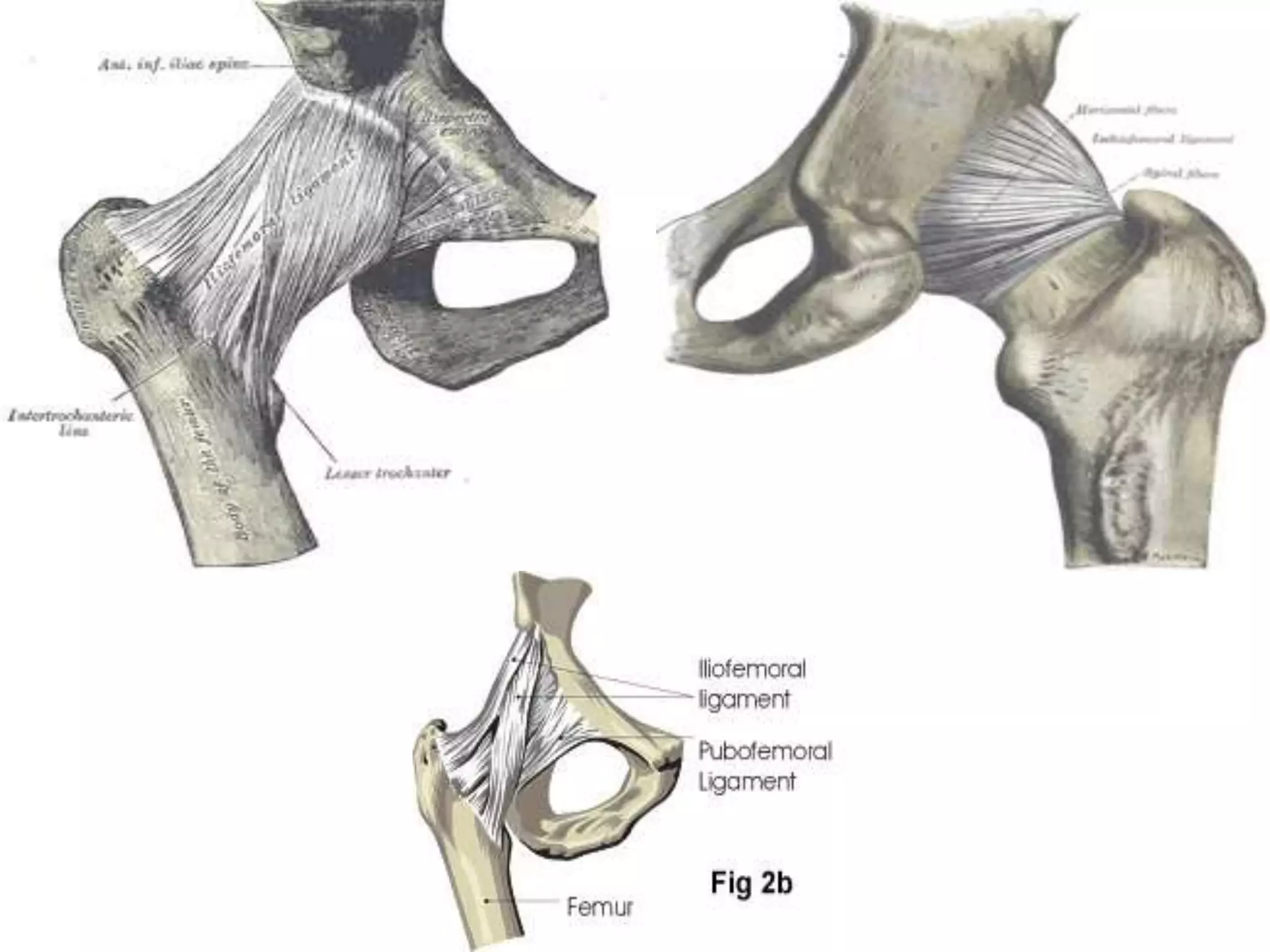 Fracture neck femur | PPT