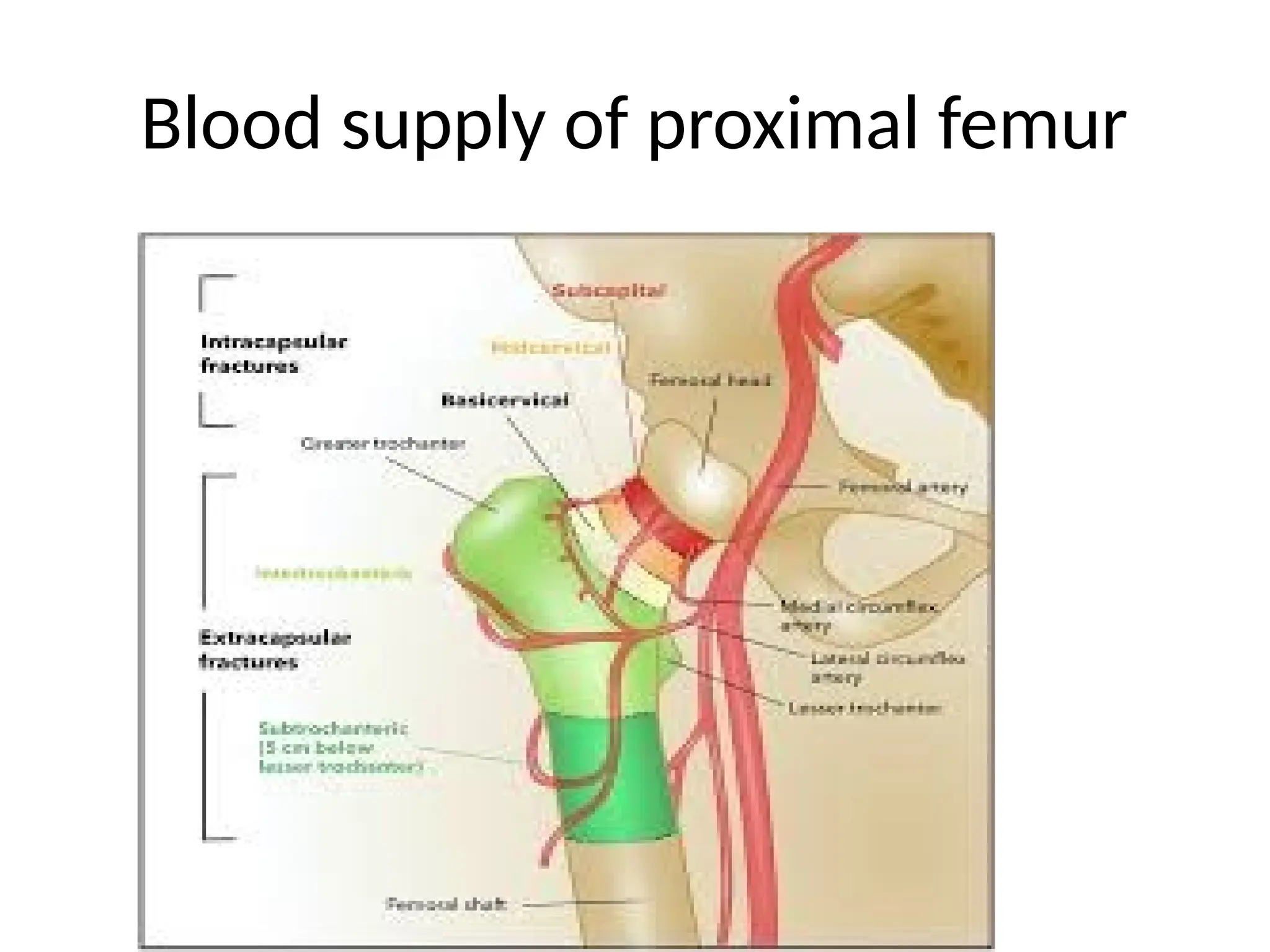 FRACTURE NECK OF FEMUR.pptx and it is a crucial lecture | PPTX