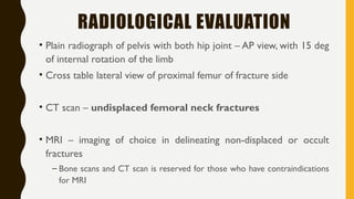 Fracture Neck of Femur Clinic al features.pptx