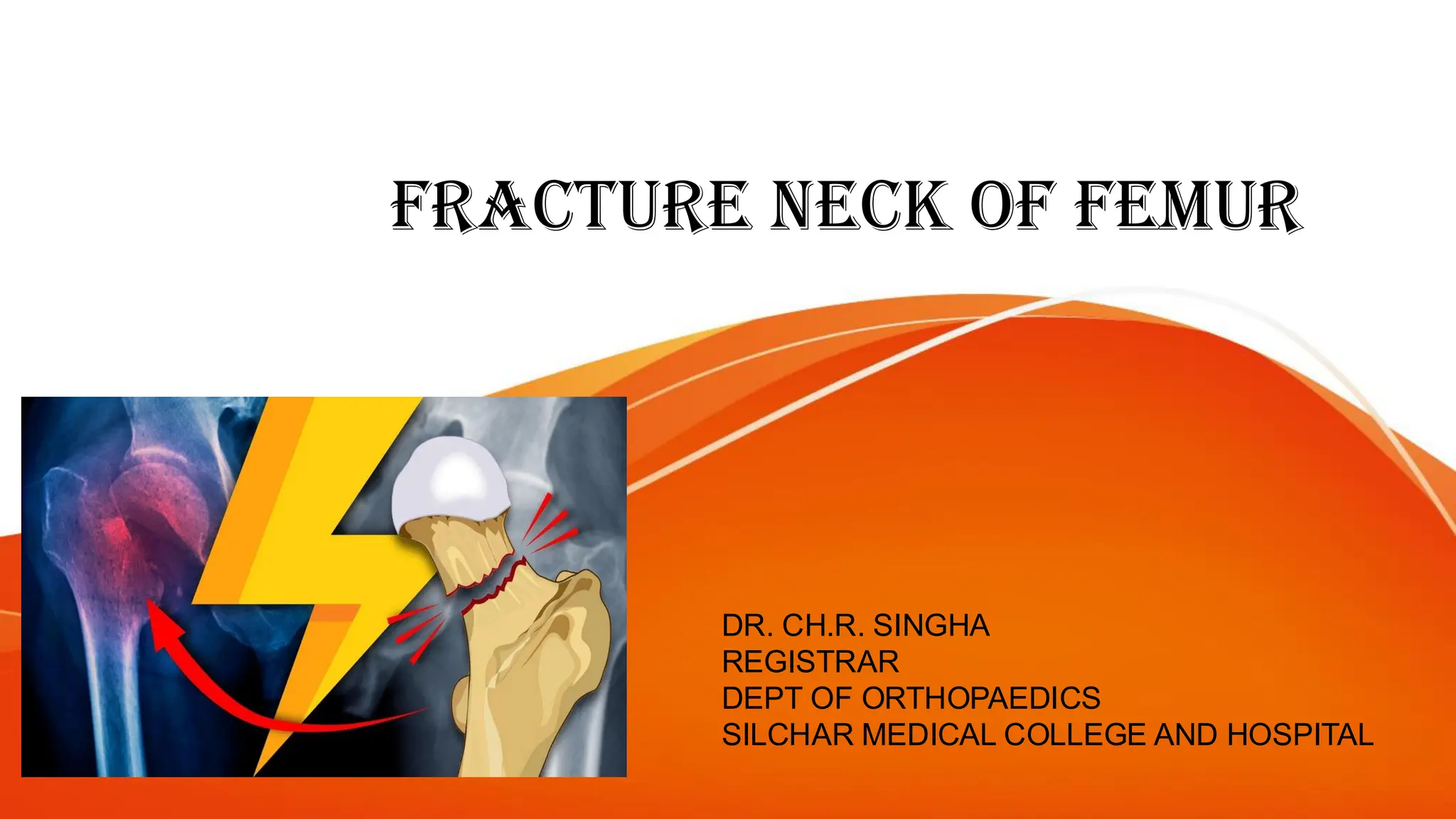 FRACTURE NECK OF FEMUR MBBS UG LECTURE.pdf