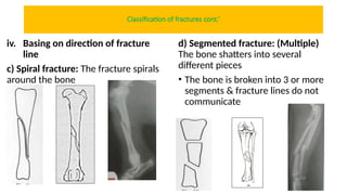 Fracture , causes, classification & managemeny | PPTX