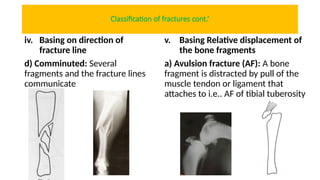 Fracture , causes, classification & managemeny | PPTX