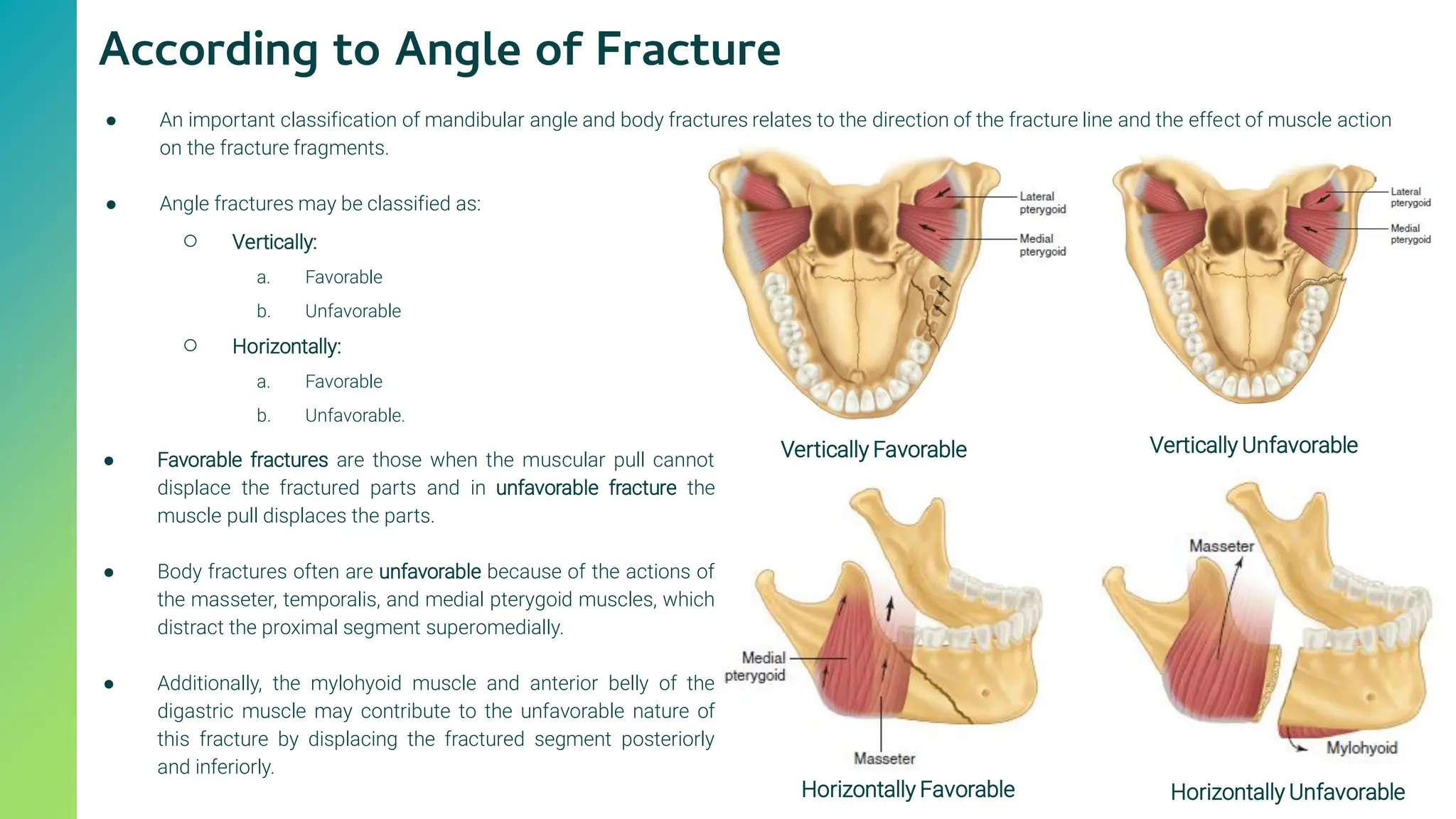 Fractures of The Body of The Mandible In Maxillofacial Surgery | PDF