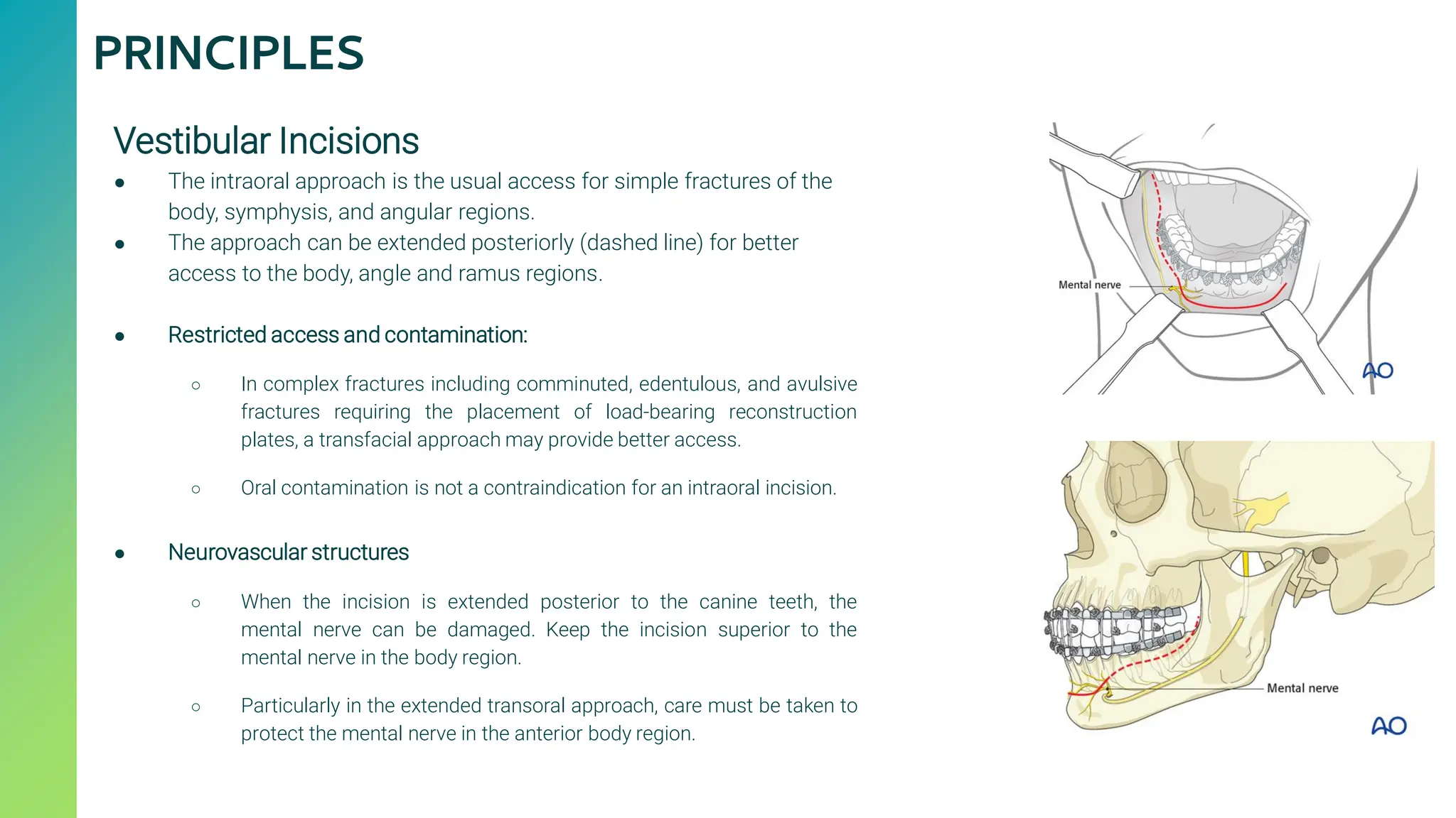 Fractures of The Body of The Mandible In Maxillofacial Surgery | PDF